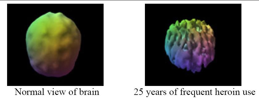 Understanding Brain Imaging – Neuroanthropology