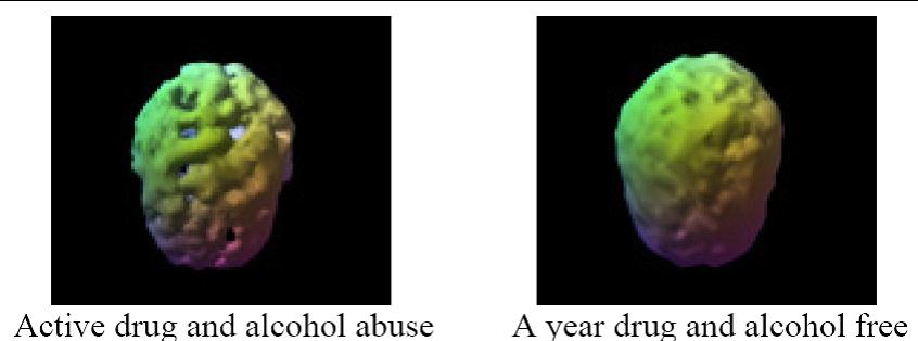 Understanding Brain Imaging – Neuroanthropology